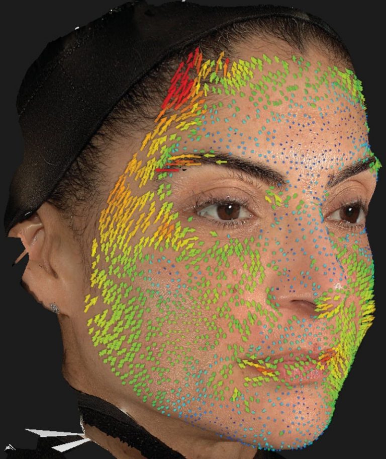 25-45um 医美用CaHA羟基磷灰石微球 - 上海伊普瑞生物